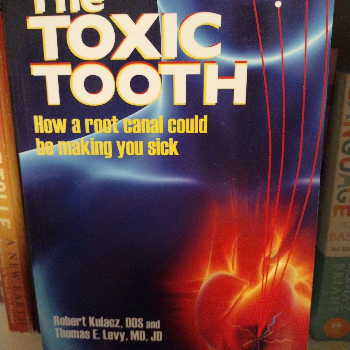 The Toxic Tooth by Robert Kulacz, Thomas E. Levy, Boyd E. Haley