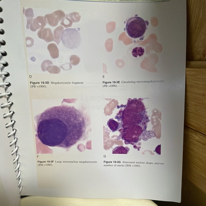 Clinical Hematology Atlas by Jacqueline H. Carr, Bernadette F. Rodak