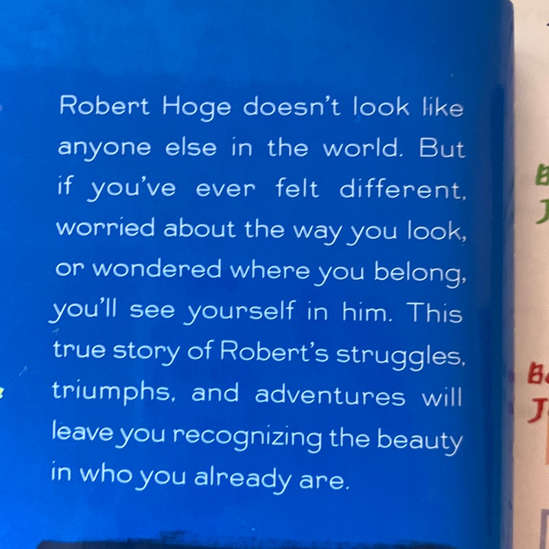 Ugly by Robert Hoge