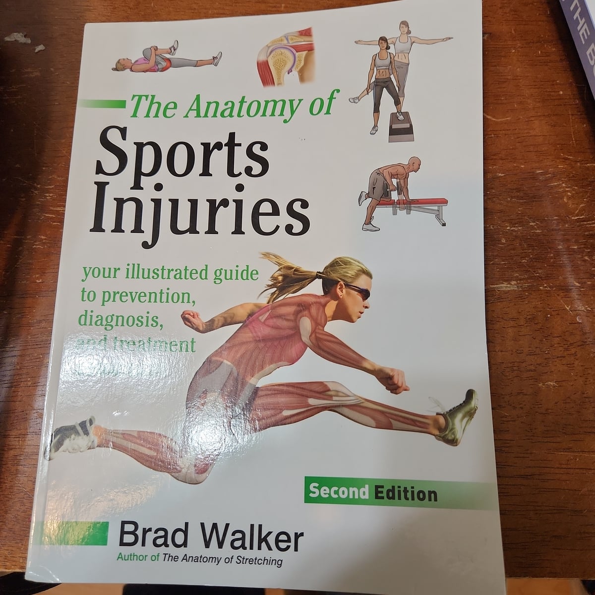 The Anatomy of Sports Injuries, Second Edition by Brad Walker