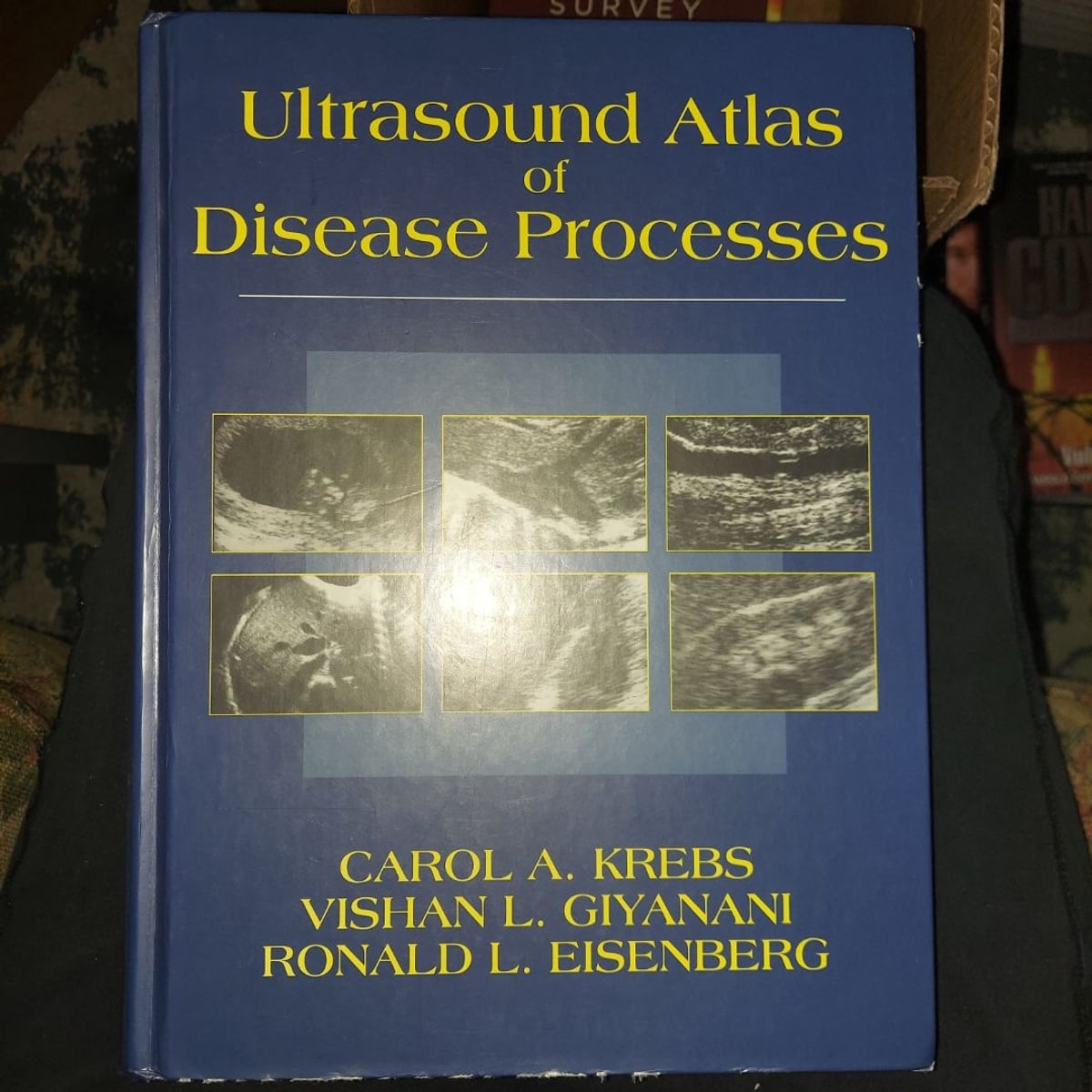 Ultrasound Atlas of Disease Processes by Carol A. Krebs, Ronald E ...