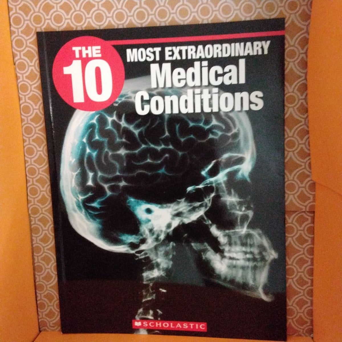 The 10 Most Extraordinary Medical Conditions by Barbara Winter
