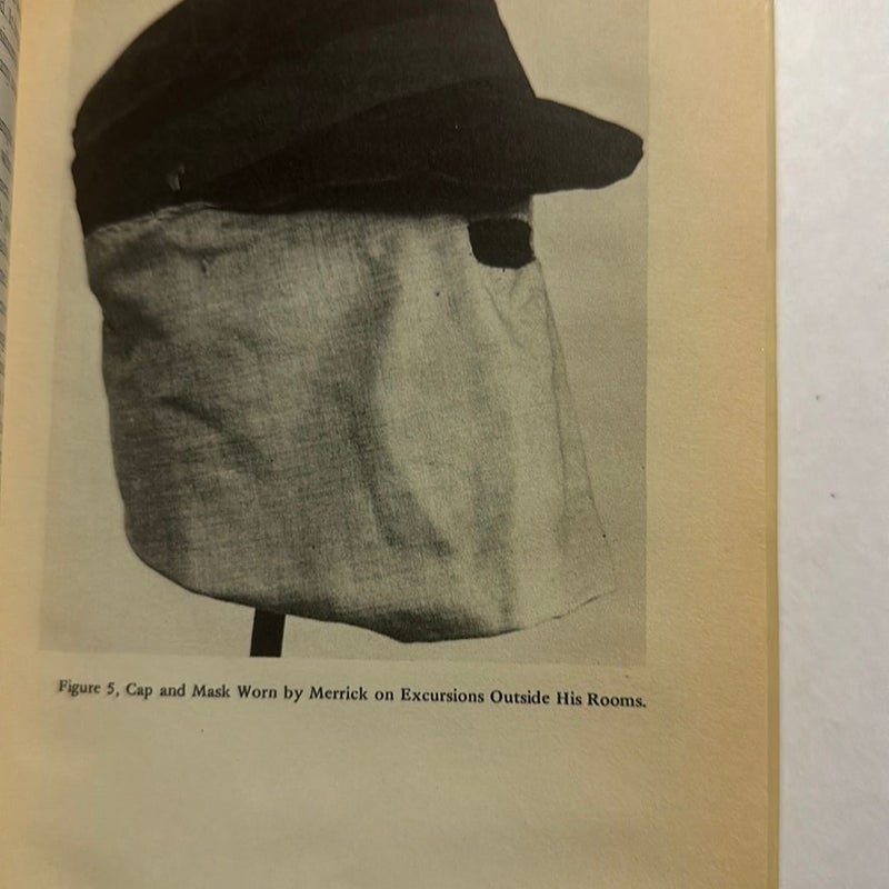 The Elephant Man by Frederick Treves, Hardcover | Pangobooks