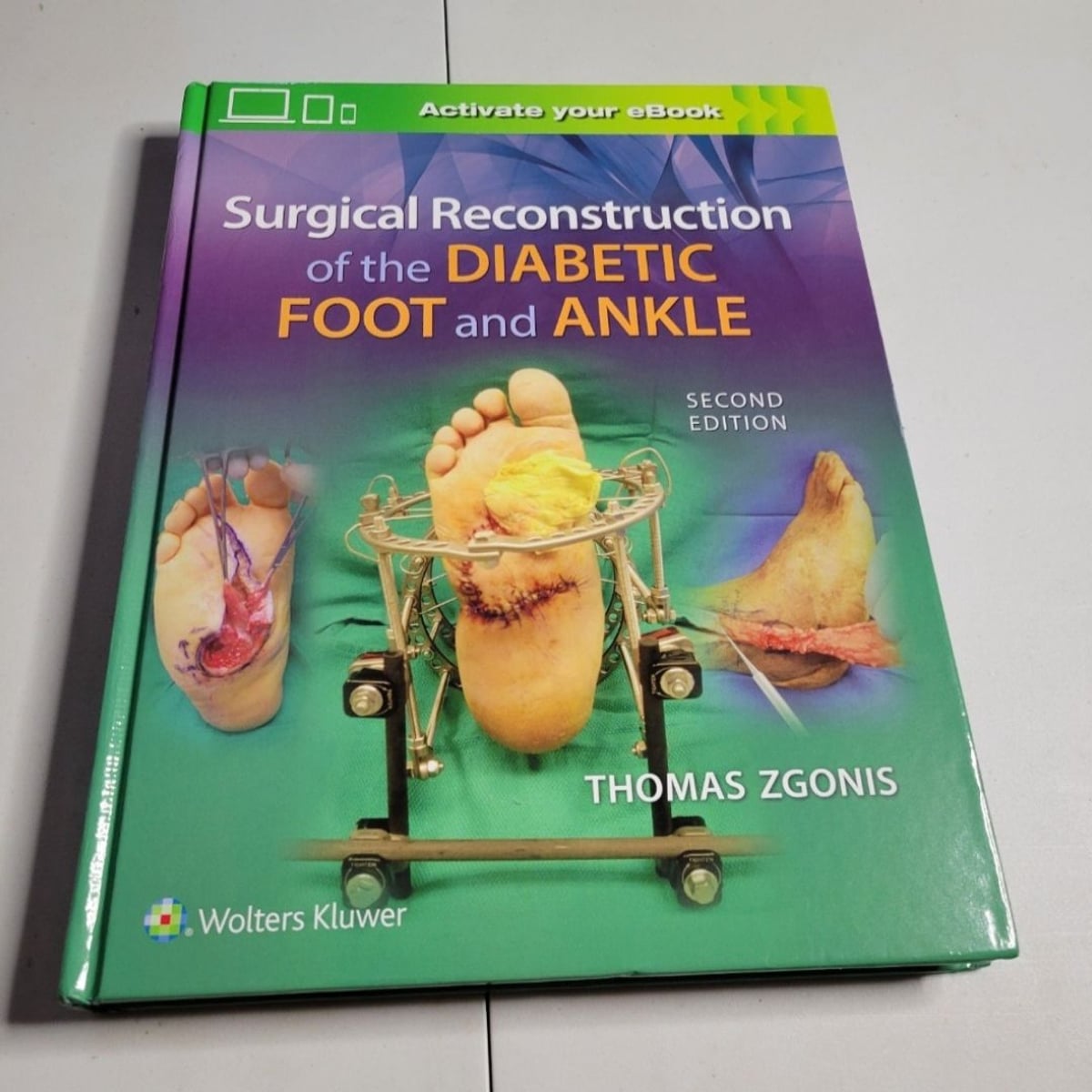 Surgical Reconstruction of the Diabetic Foot and Ankle by Thomas Zgonis