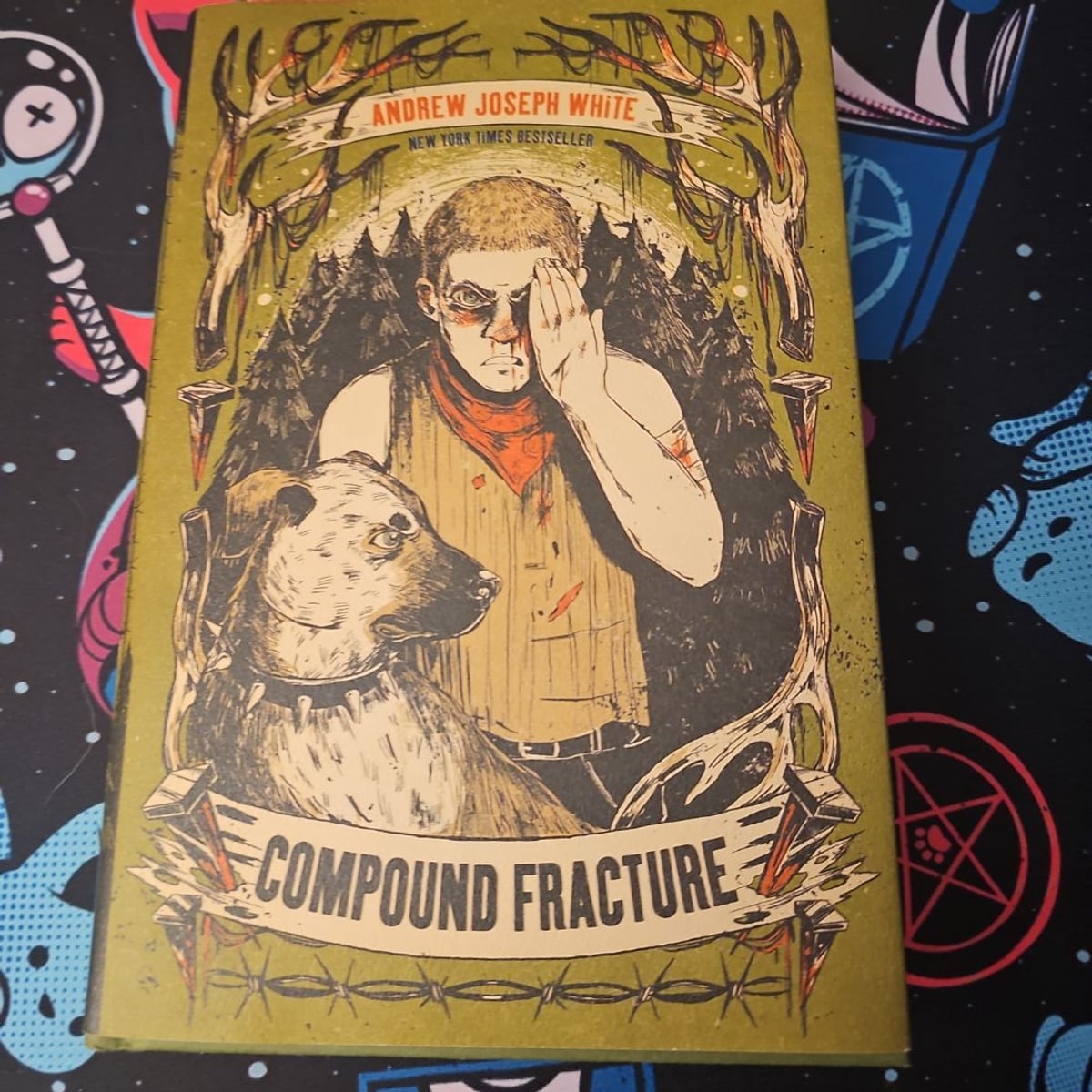 Compound Fracture by Andrew Joseph White