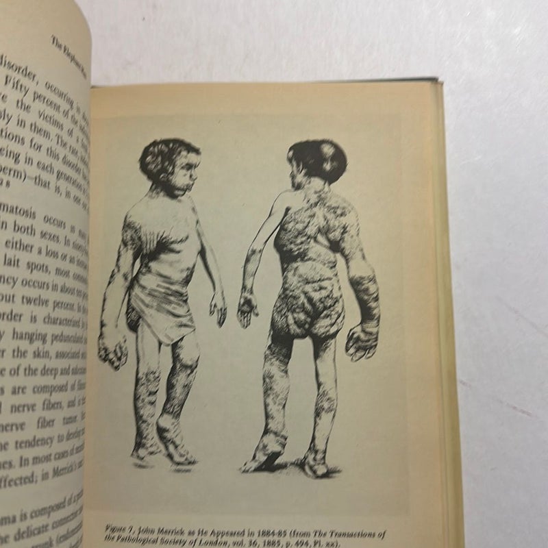 The Elephant Man by Frederick Treves, Hardcover | Pangobooks