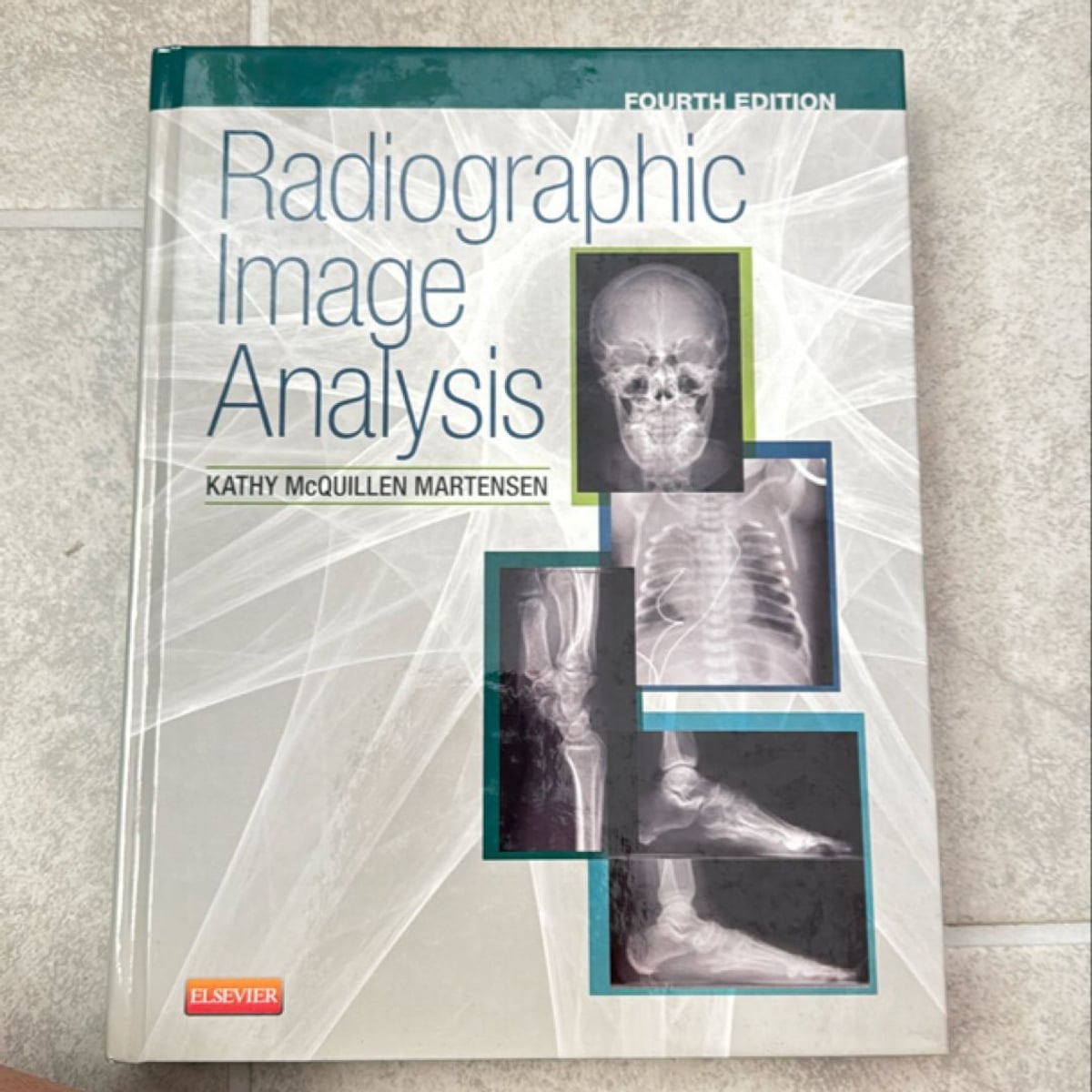 Radiographic Image Analysis by Kathy McQuillen-Martensen