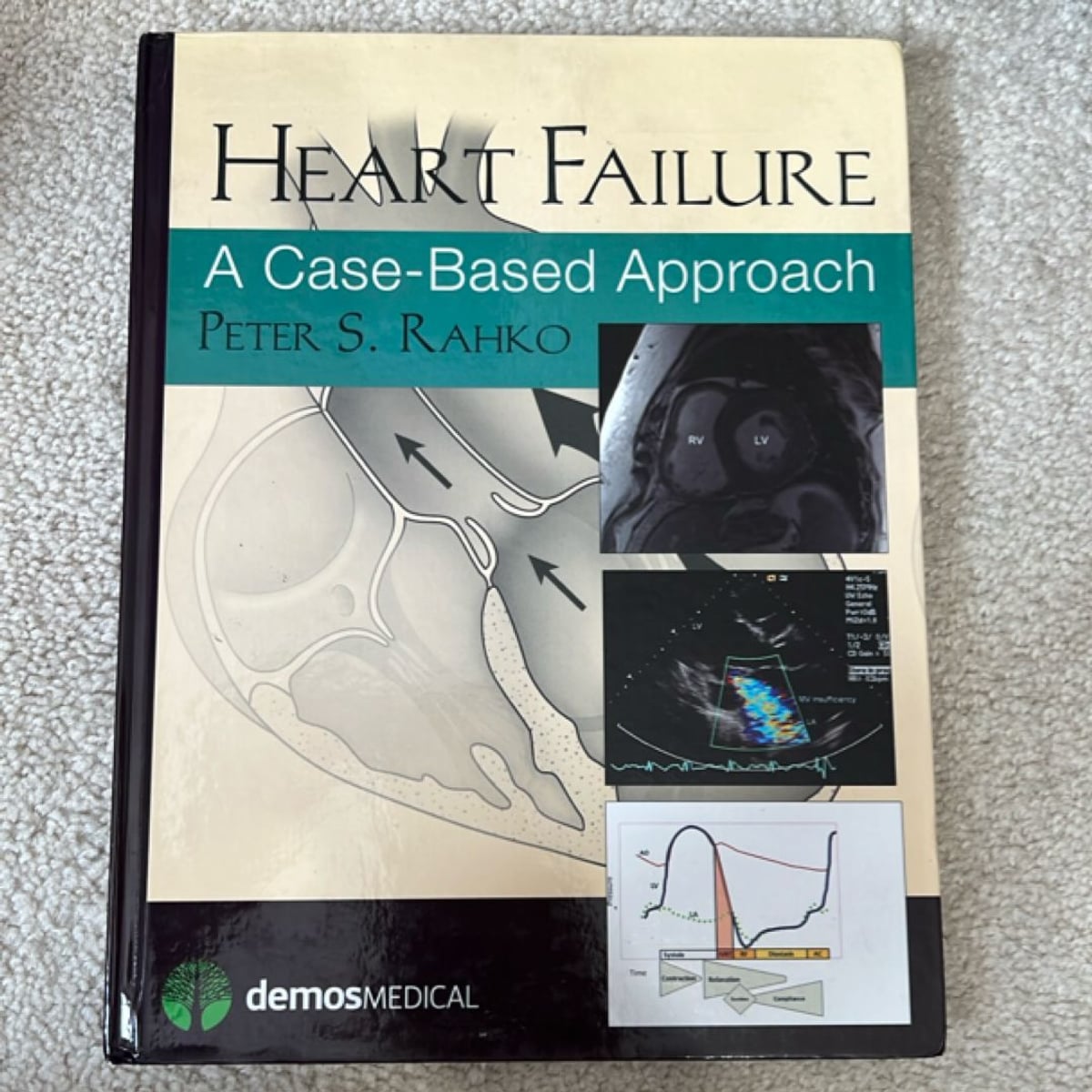 Heart Failure by Peter S. Rahko