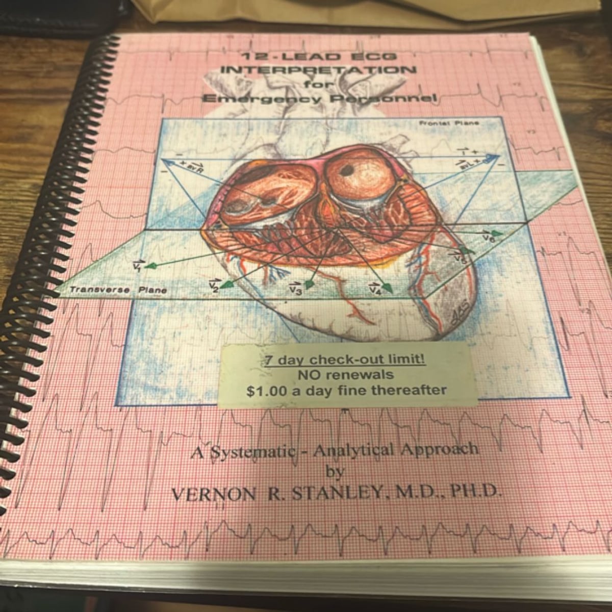12-Lead ECG Interpretation for Emergency Personnel by Stanley