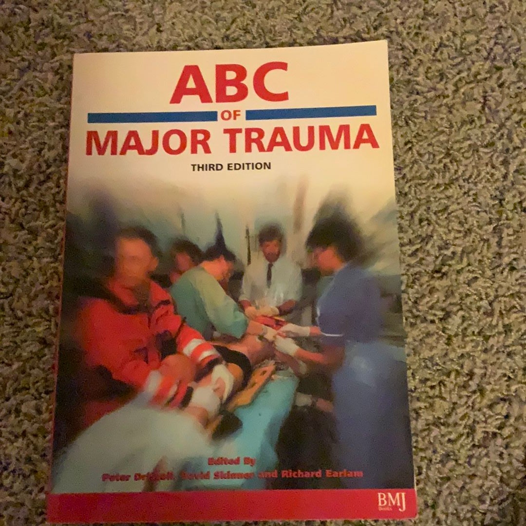 Major Trauma by Anthony Deane, Oliver Fenton, David A. Alexander, Peter ...